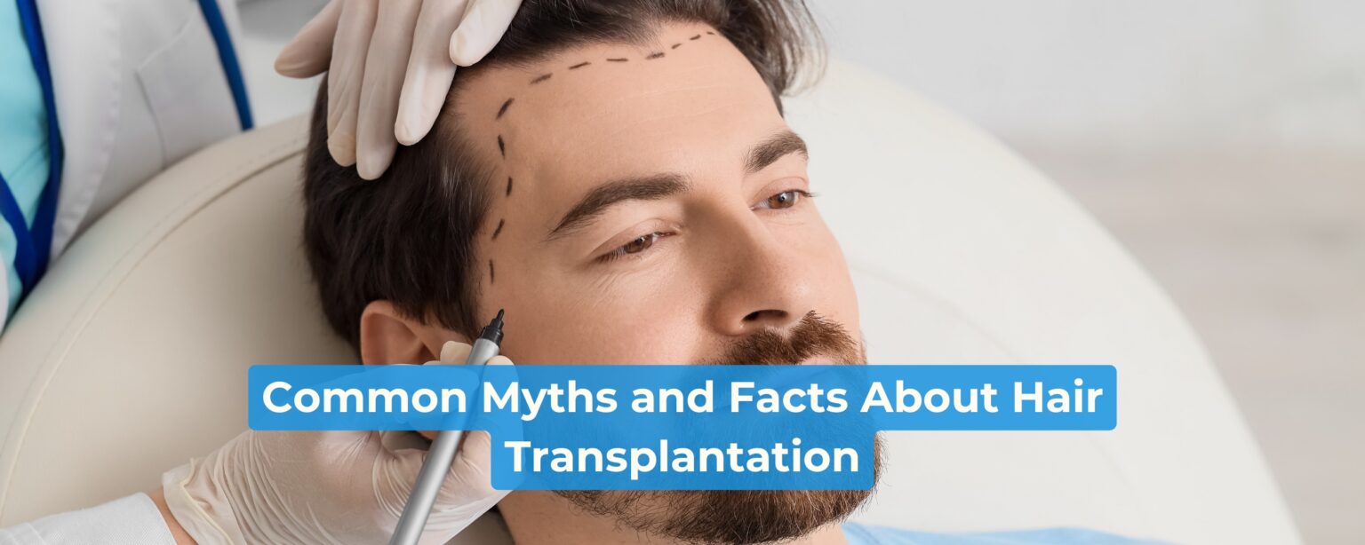 Common Myths and Facts About Hair Transplantation GIA CLINICS